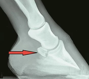 Navicular Syndrome: What Every Horse Owner Should Know - 4theloveofhorses